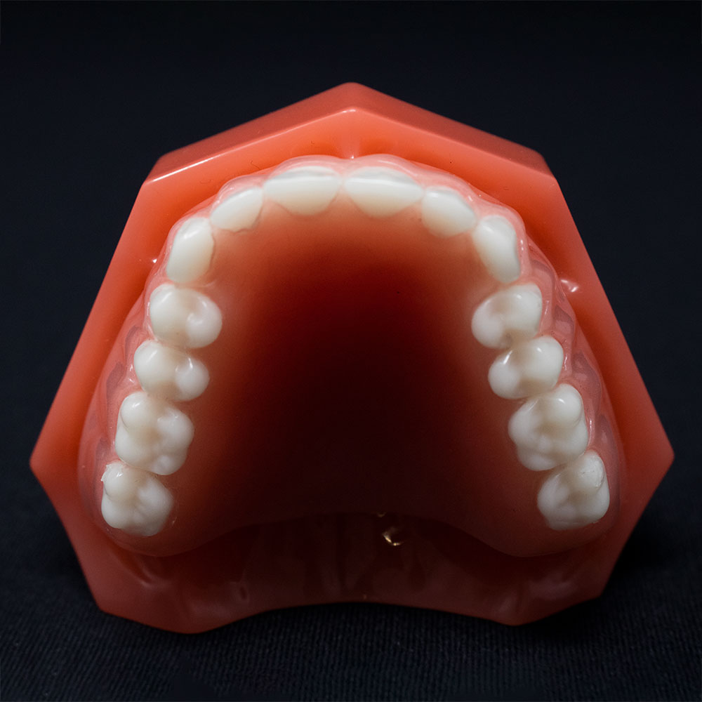 Fully Edentulous Maxilla Base with Denture - BoneModels™