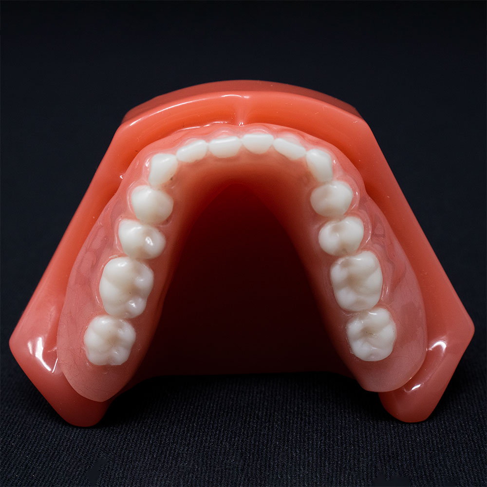 Fully Edentulous Mandible Base with Denture - BoneModels™