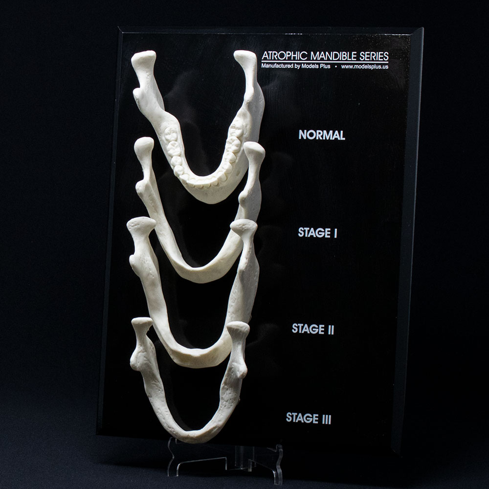 Dental Models - BoneModels™