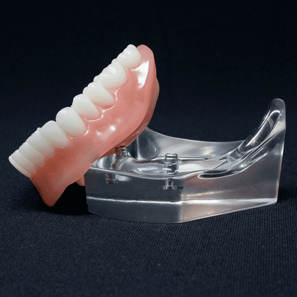 Two Implant Locator - BoneModels™