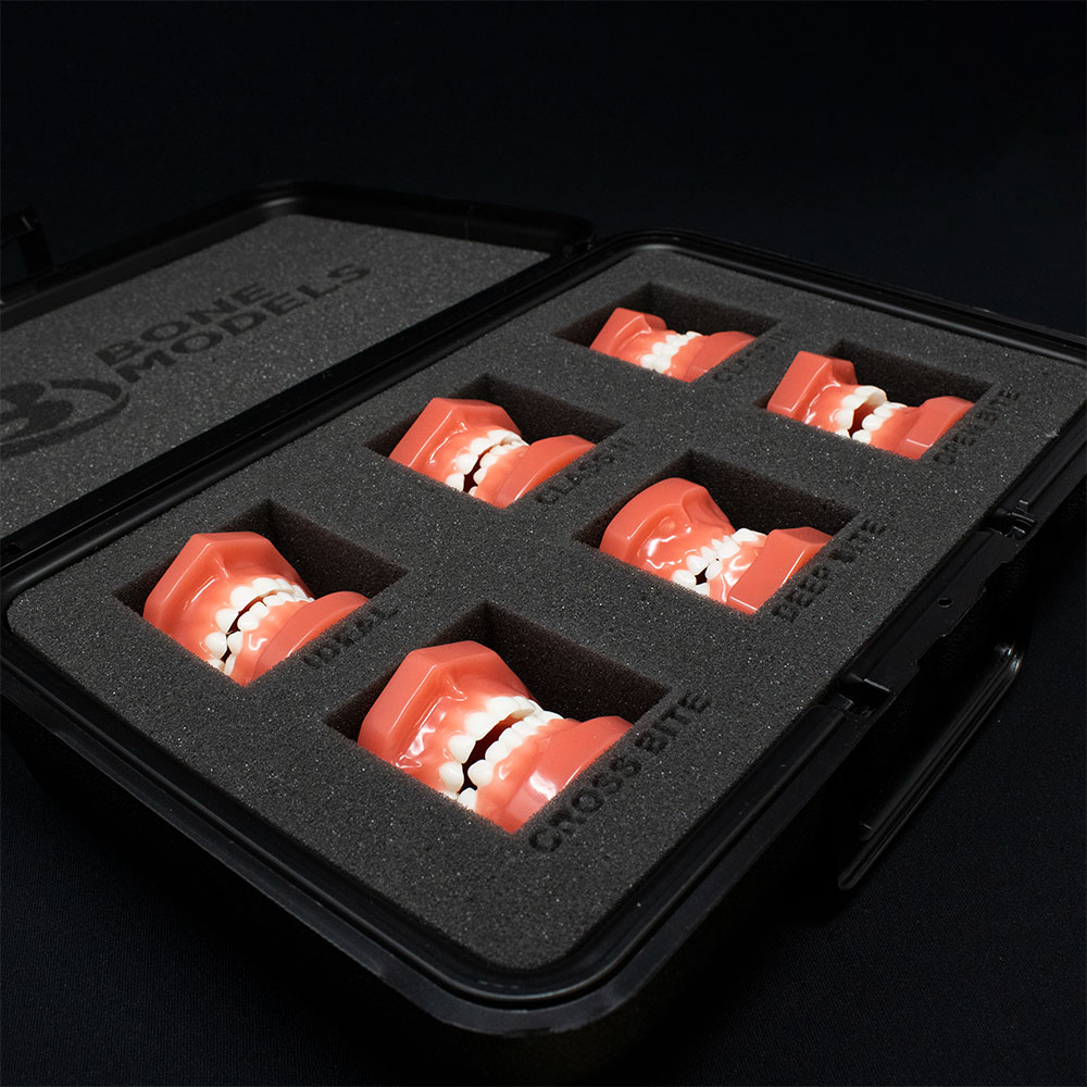 Implant Education Bundle - BoneModels™